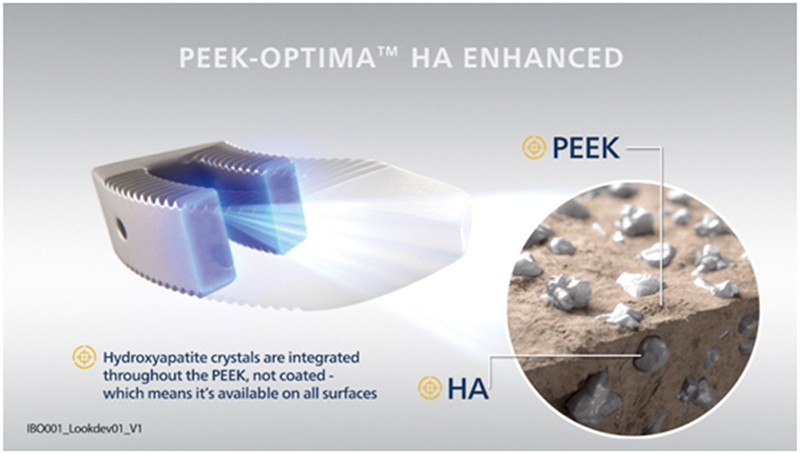 INVIBIO | ORTHOmaterials